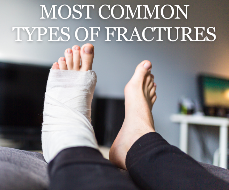 Most Common Types of Fractures | Foot & Ankle Associates of South Florida